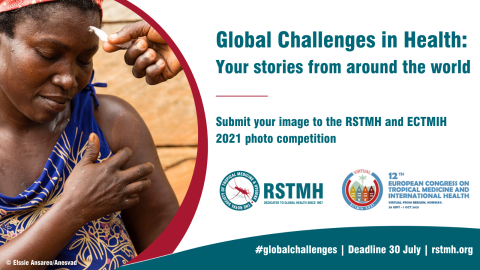 "Global Challenges in Health" – RSTMH and ECTMIH 2021 photo contest | RSTMH